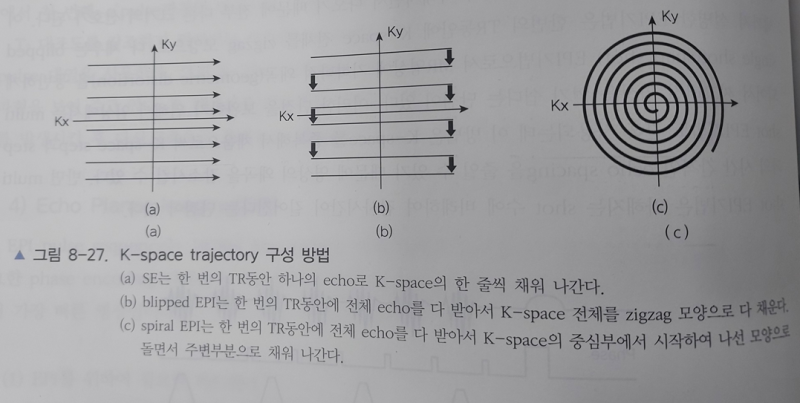 EPI(Echo Planar imaging) : 네이버 블로그