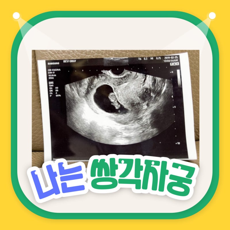 쌍각자궁 임신 초산 유도분만 실패 제왕절개 출산후기 네이버 블로그