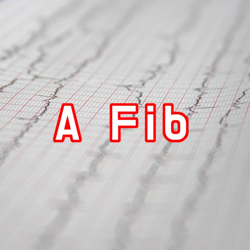 A Fib 리듬을 단번에 알아보는 방법? : 네이버 블로그