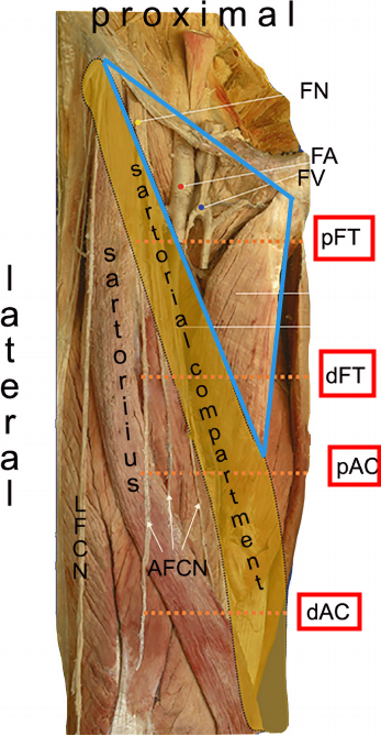 [정형외과 전문의] 하지 신경차단술 (Femoral n block~ankle block etc.) : 네이버 블로그