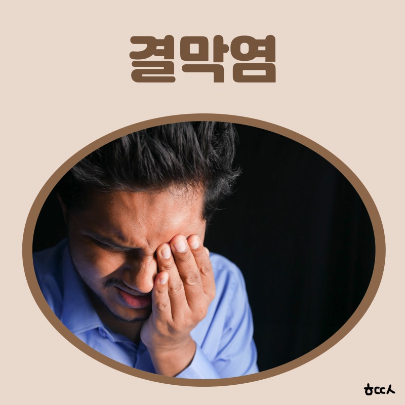 결막염 원인 결막염 증상 전염 코로나 결막염 유행성 바이러스성 알레르기성 안약 눈충혈 네이버 블로그