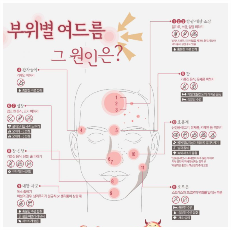 얼굴 부위별 여드름 원인 총정리 이마 미간 코 인중 볼 관자놀이 뾰루지 네이버 블로그