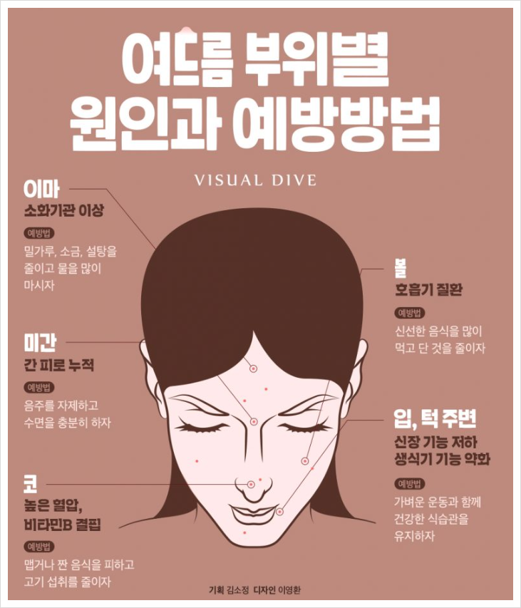 얼굴 부위별 여드름 원인 총정리 이마 미간 코 인중 볼 관자놀이 뾰루지 네이버 블로그