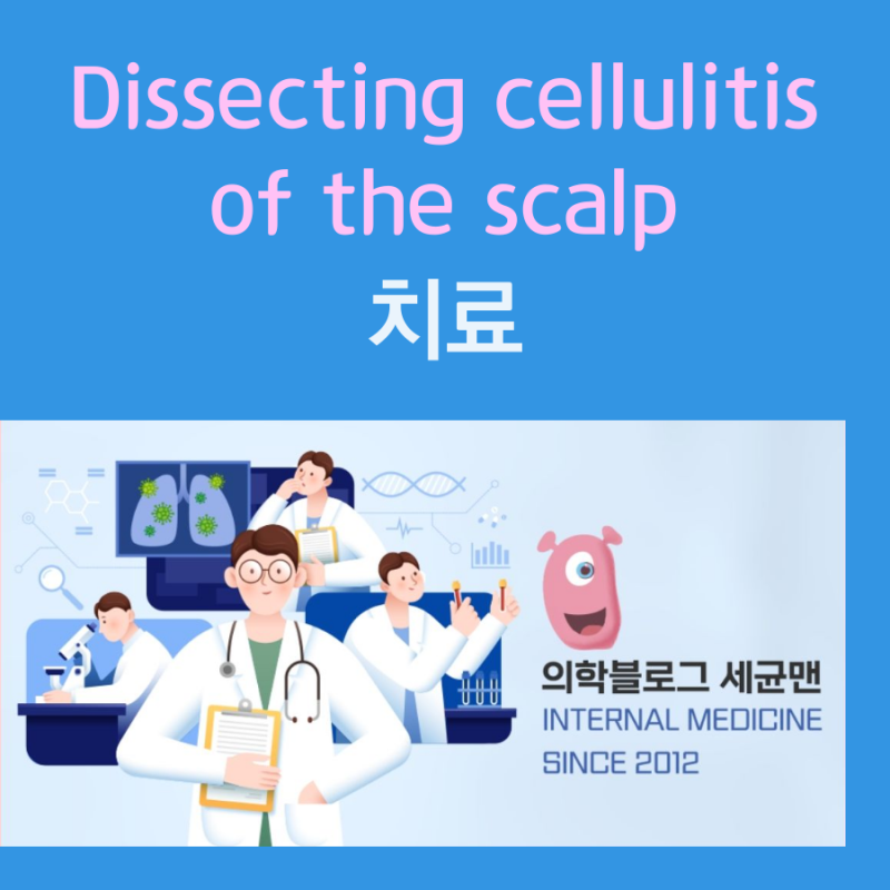 Dissecting cellulitis of the scalp (DCS) 치료 : 독시사이클린, 미노사이클린, 이소트레티노인 ...