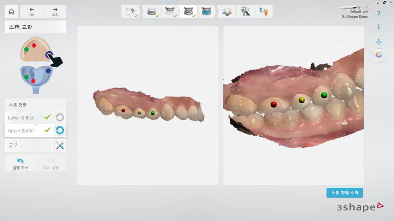 [3Shape Unite] 바이트스캔 수동 정렬하는 방법 : 네이버 블로그