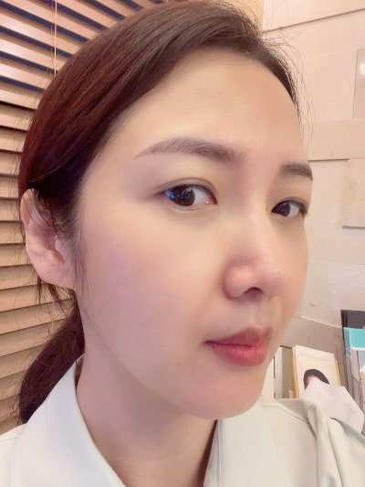 얼굴 실리프팅 팔자주름 펴진 후기 실리프팅 가격 실리프팅 통증 붓기 실리프팅 내돈내산 미친v리프팅 네이버 블로그