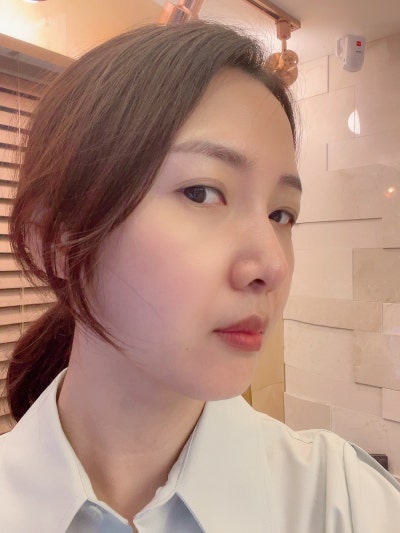 얼굴 실리프팅 팔자주름 펴진 후기 실리프팅 가격 실리프팅 통증 붓기 실리프팅 내돈내산 미친v리프팅 네이버 블로그