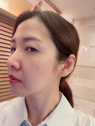 얼굴 실리프팅 팔자주름 펴진 후기 실리프팅 가격 실리프팅 통증 붓기 실리프팅 내돈내산 미친v리프팅 네이버 블로그