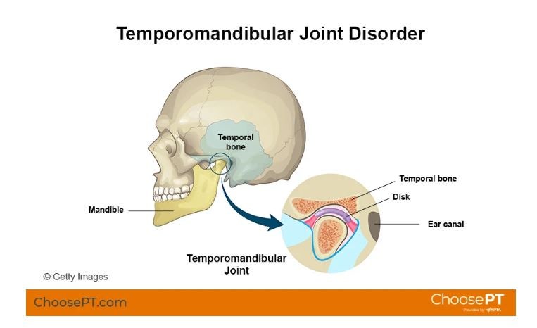 TM joint (Temporomandibular Joint) 턱이 아파요. : 네이버 블로그
