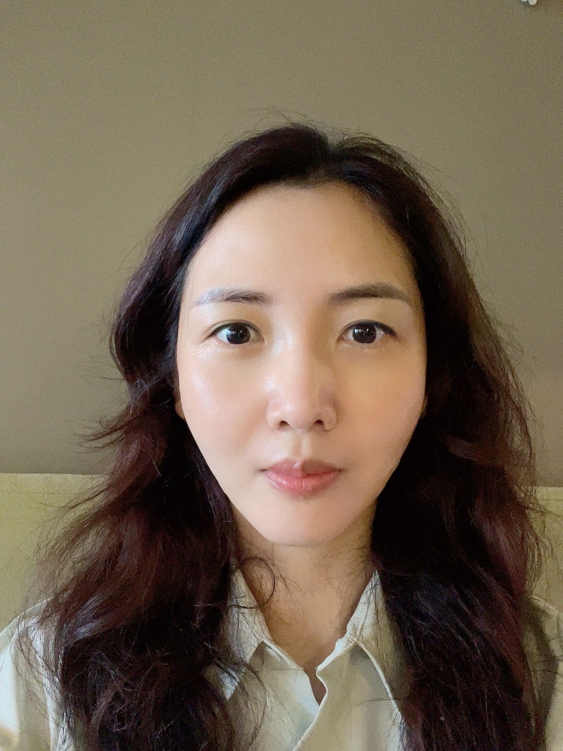 얼굴 실리프팅 팔자주름 펴진 후기 실리프팅 가격 실리프팅 통증 붓기 실리프팅 내돈내산 미친v리프팅 네이버 블로그