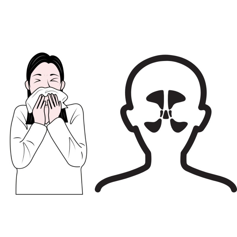 슈다페드정 슈다페드정 약리작용 슈도에드페린 성분분석 슈다페드정 금기 복용법 부작용 네이버 블로그