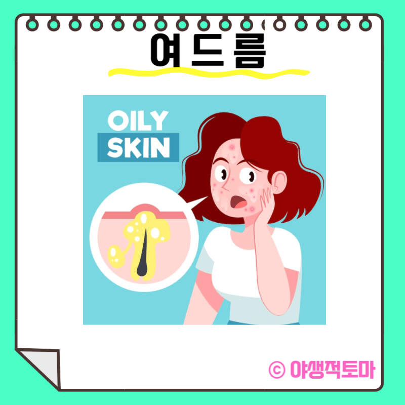 여드름약 페어아크네 연고 애크논 크림 큐아크네 클리어틴이부더블스팟톡크림 성분 작용기전 효능 부작용 네이버 블로그