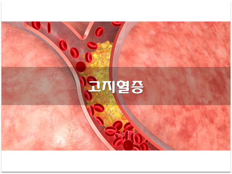 리바로 리바로정 1mg 2mg 4mg 고지혈증 고콜레스테롤혈증 이상지질혈증 약 스타틴statin 부작용 성분 효능 효과