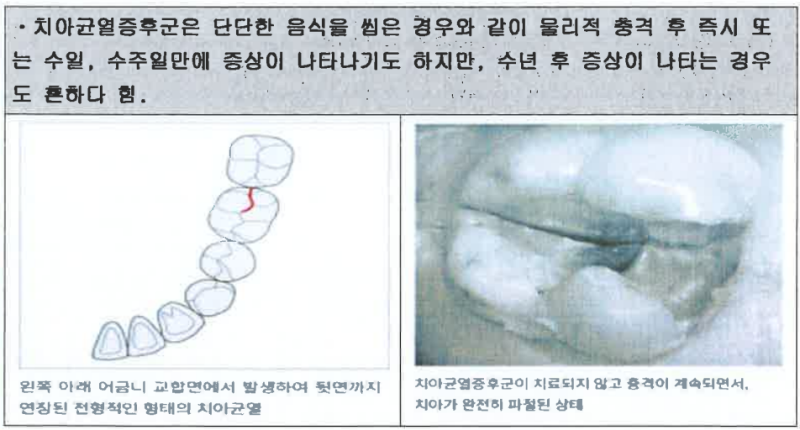 사례 음식물배상책임보험 치아파절 사고 네이버 블로그