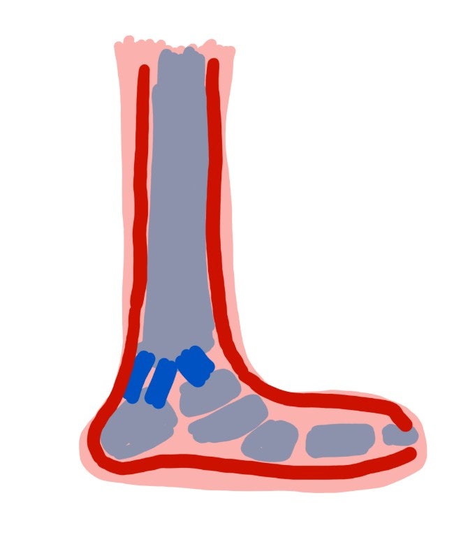 ankle fracture 발목 골절 short leg splint (SLS) 하는법과 주의점 : 네이버 블로그