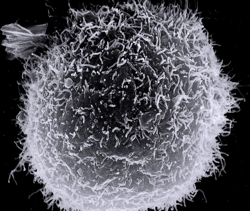 Diff Count Differential Count 백혈구 백분율 검사 알아보기 : 네이버 블로그