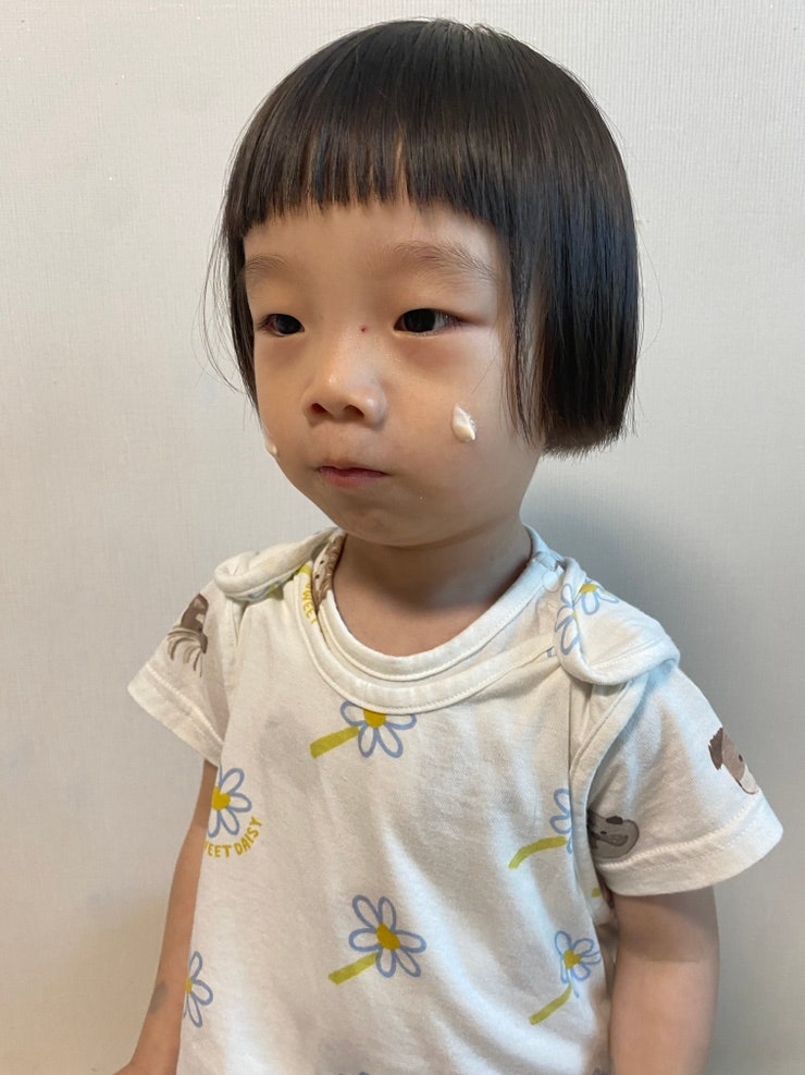 강력 보습 아기로션 추천 비더마틱 울트라로션 네이버 블로그