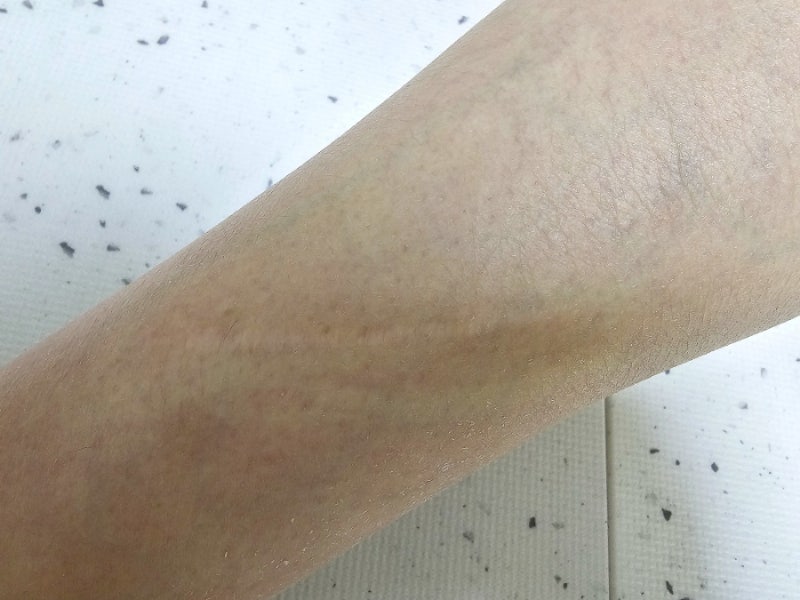 제왕절개 흉터제거 출산준비물 시카케어 겔 시트 네이버 블로그