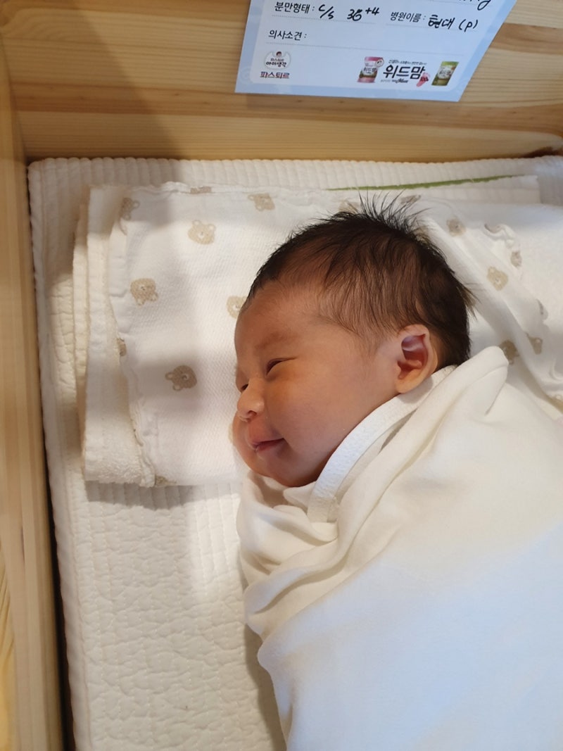 내돈내산 아기 두피 각질 지루성피부염 열이 많은 아기 무스텔라 네이버 블로그