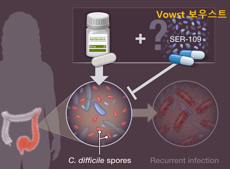 FDA는 클로스트리디오이데스 디피실 재발 방지를 위한 새로운 경구 치료제를 승인하였습니다 2023.04.26 : 네이버 블로그