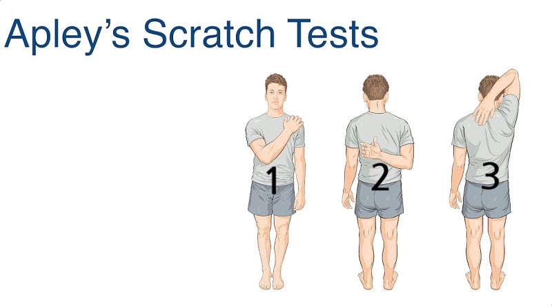 오십견 좋은 운동(오십견어깨운동) 6가지 및 스페셜테스트 : 네이버 블로그