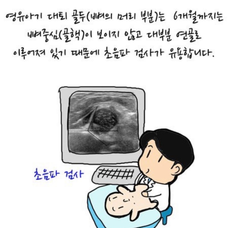 [육아일기] 발달성 고관절 이형성증 | 역아 고관절탈구의심 | 제주대학교병원 정형외과 | 신생아 고관절 초음파검사 : 네이버 블로그