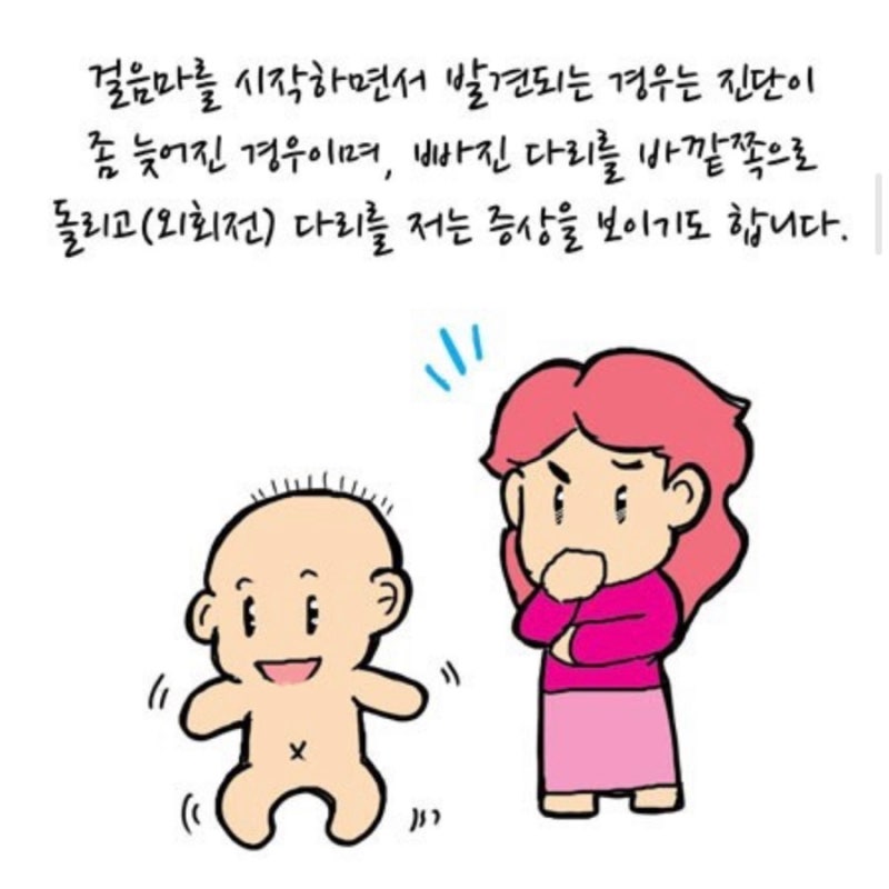 [육아일기] 발달성 고관절 이형성증 | 역아 고관절탈구의심 | 제주대학교병원 정형외과 | 신생아 고관절 초음파검사 : 네이버 블로그