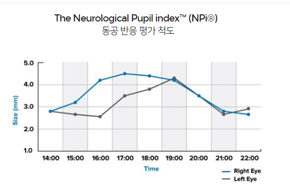 Pupilometer , NPi 동공측정계 : 네이버 블로그