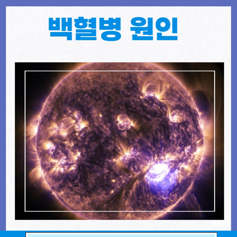 백혈병 초기증상 원인 골수이식 급성 소아 백혈병 증상 생존율 네이버 블로그