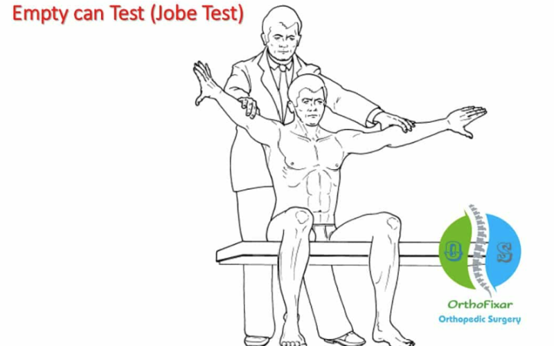 검사법 10. empty can test / Jobe test 엠티캔 테스트 깡통비우기검사 : 네이버 블로그