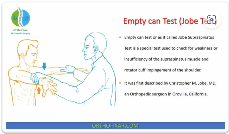 검사법 10. empty can test / Jobe test 엠티캔 테스트 깡통비우기검사 : 네이버 블로그