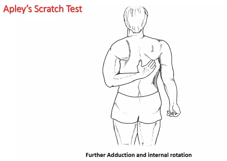 검사법 8. Apley's Scratch Test 애플리 아플리 긁기 검사 : 네이버 블로그