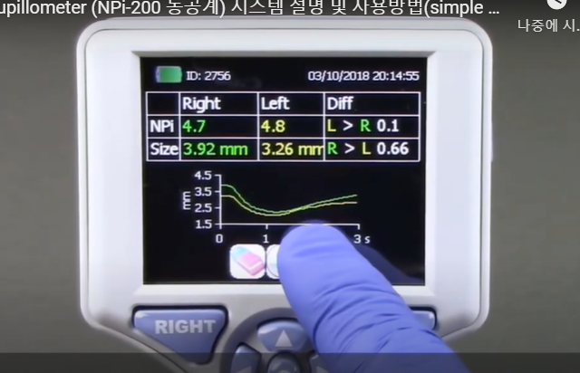 Pupilometer , NPi 동공측정계 : 네이버 블로그