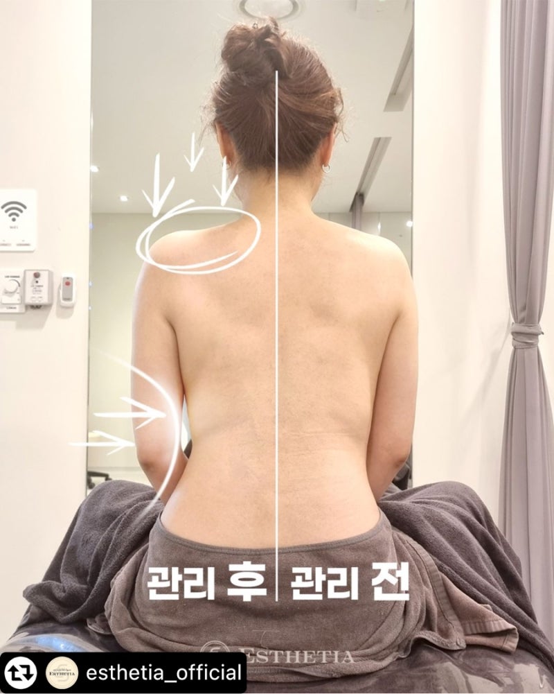 에스테티아고양원흥역점에서 워너비 바디라인만들기 네이버 블로그