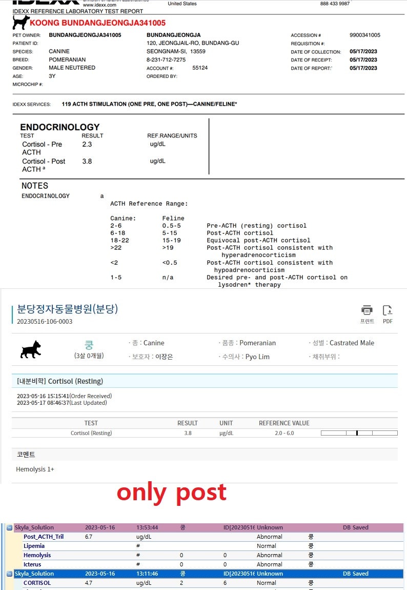 부신피질기능항진증, 쿠싱증후군의 진단과 치료 비교 : 네이버 블로그