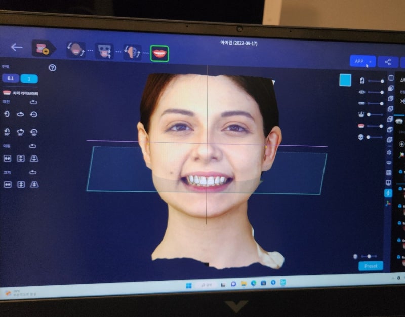 레이 페이스 2(RayFace 200) 디지털 덴티스트리 3D Face Scanner 레이페이스2 설치 작동 3D 안면스캐너 ...