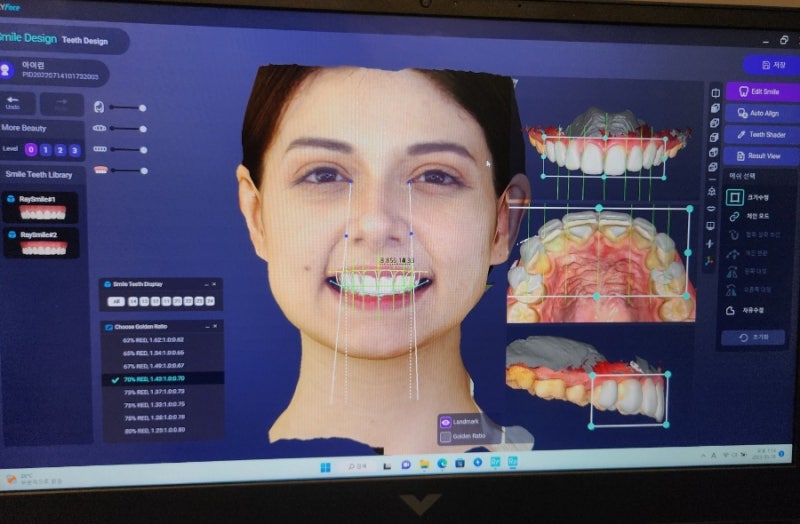 레이 페이스 2(RayFace 200) 디지털 덴티스트리 3D Face Scanner 레이페이스2 설치 작동 3D 안면스캐너 ...