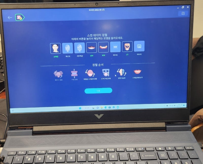 레이 페이스 2(RayFace 200) 디지털 덴티스트리 3D Face Scanner 레이페이스2 설치 작동 3D 안면스캐너 ...