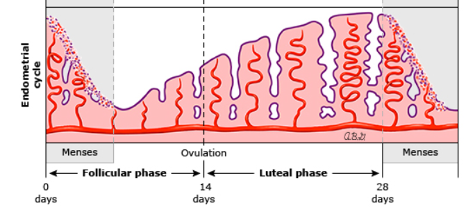 자궁내막 증식증이 무엇인가요 Endometrial Hyperplasia 네이버 블로그