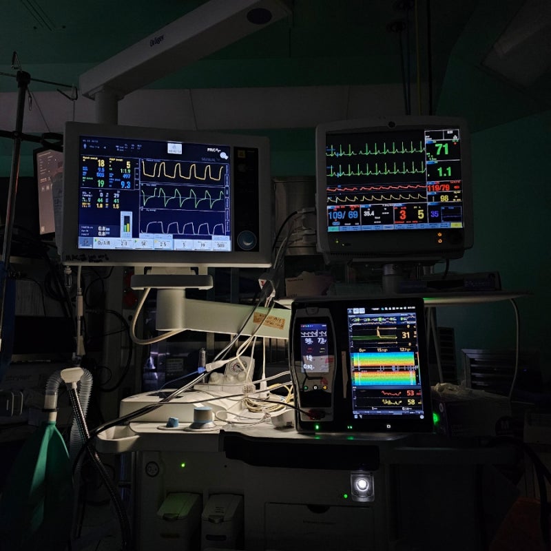 마취중 지속적 통증감시 진통통각지수 모니터링 (ANI monitoring) : 네이버 블로그