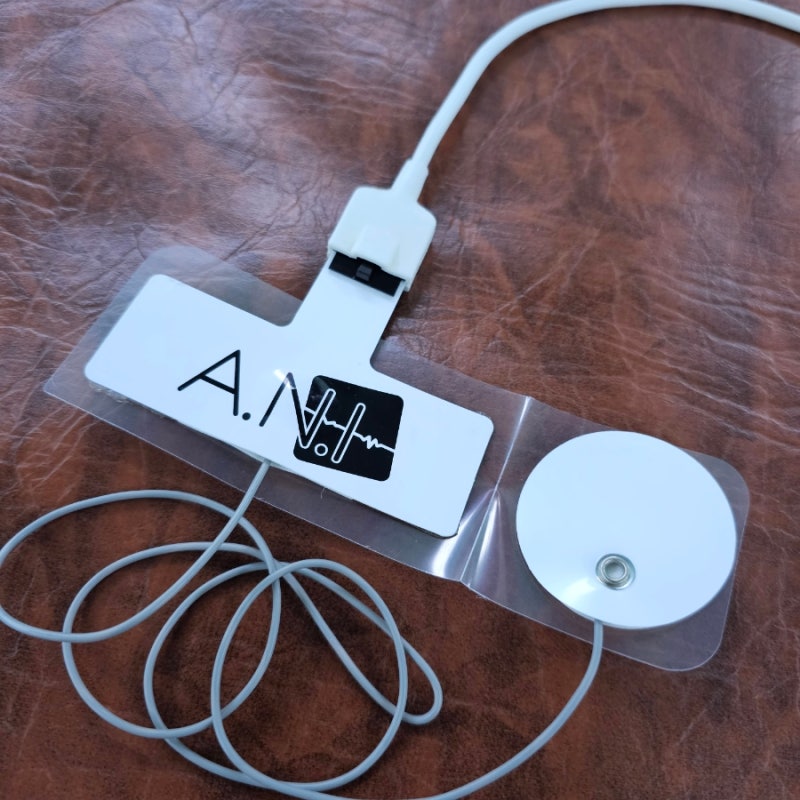 마취중 지속적 통증감시 진통통각지수 모니터링 (ANI monitoring) : 네이버 블로그