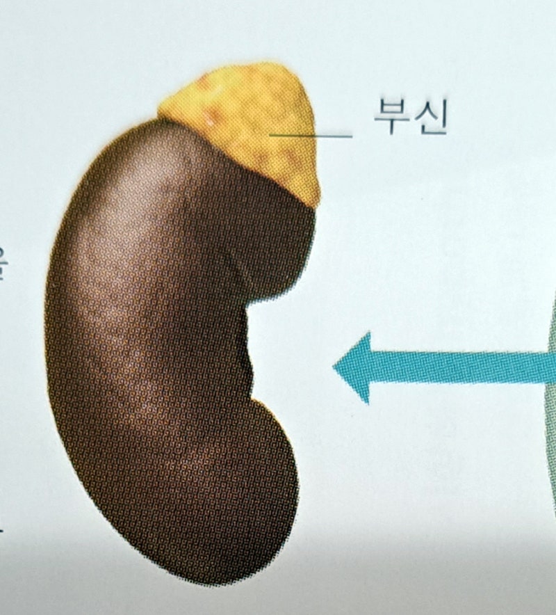 부신 기능저하증 피로증후군 부신피질호르몬 역할 검사 에디슨병 쿠싱증후군 원인 증상 네이버 블로그