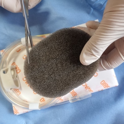 [방문간호] 집에서 욕창음압치료 생생후기 / Curasys / Curavac / NPWT / 큐라시스 / 실제욕창사진주의 ...