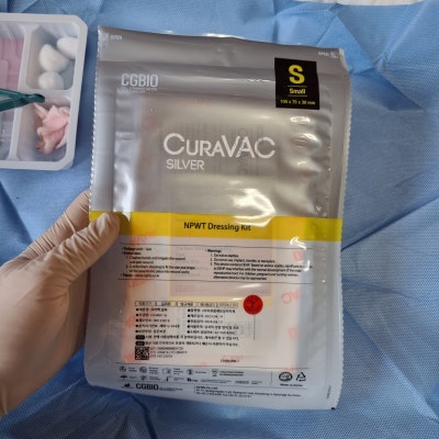 [방문간호] 집에서 욕창음압치료 생생후기 / Curasys / Curavac / NPWT / 큐라시스 / 실제욕창사진주의 ...