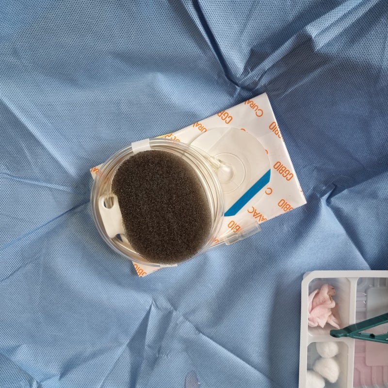 [방문간호] 집에서 욕창음압치료 생생후기 / Curasys / Curavac / NPWT / 큐라시스 / 실제욕창사진주의 ...