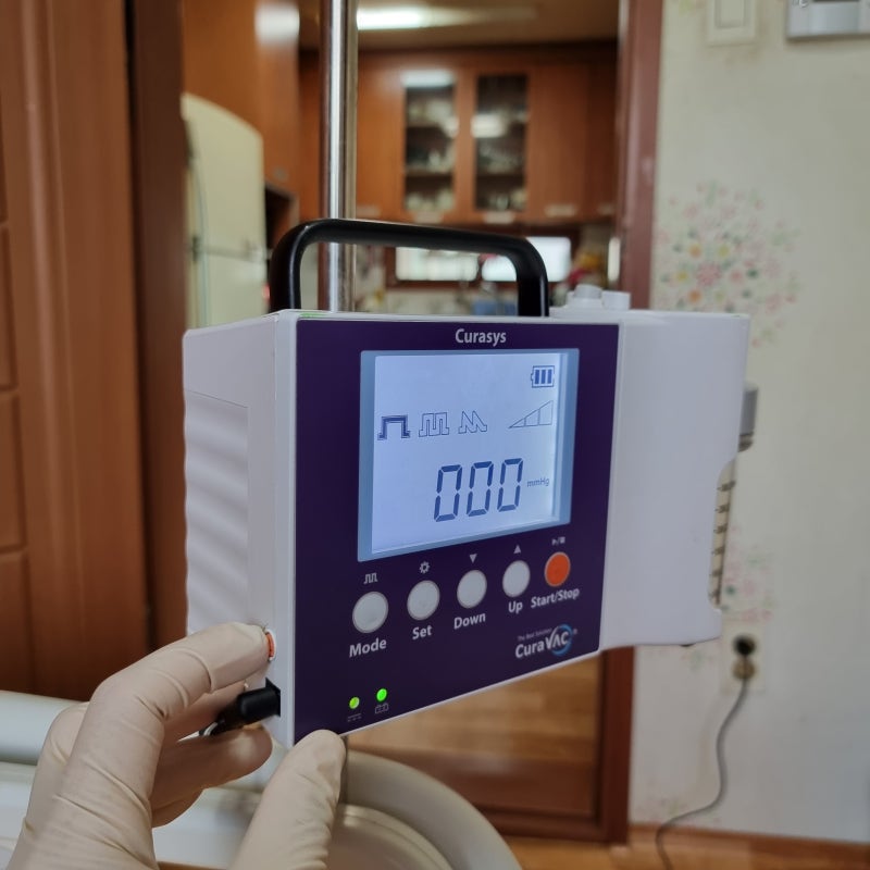 [방문간호] 집에서 욕창음압치료 생생후기 / Curasys / Curavac / NPWT / 큐라시스 / 실제욕창사진주의 ...