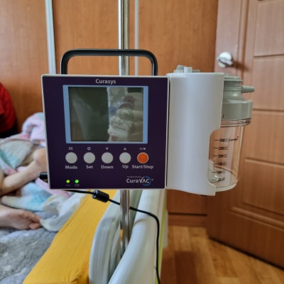 [방문간호] 집에서 욕창음압치료 생생후기 / Curasys / Curavac / NPWT / 큐라시스 / 실제욕창사진주의 ...