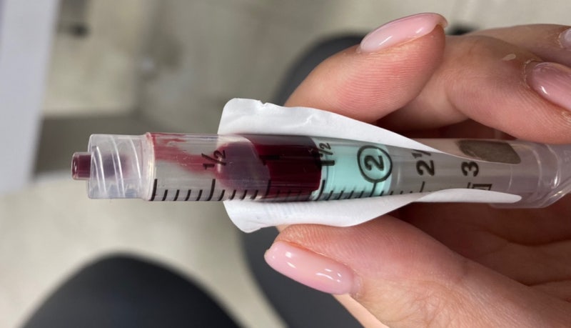 ABGA 동맥혈 가스 분석 검사란? 검사결과 해석방법! : 네이버 블로그