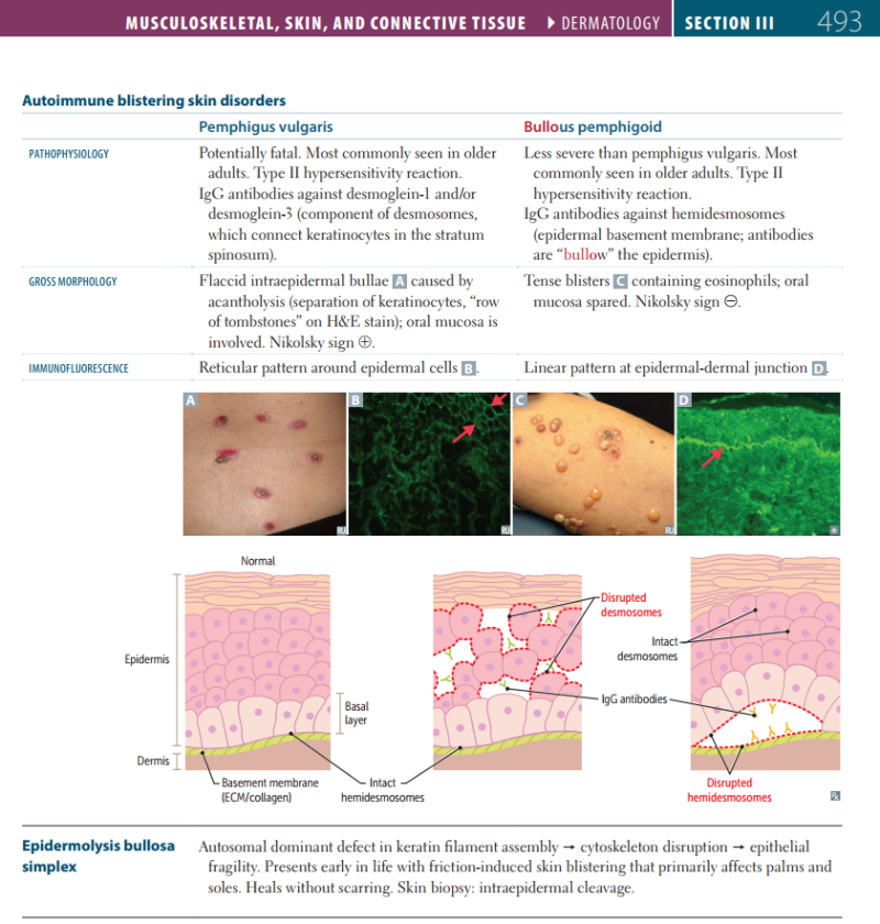 수포성 유사천포창 [Bullous pemphigoid] : 네이버 블로그