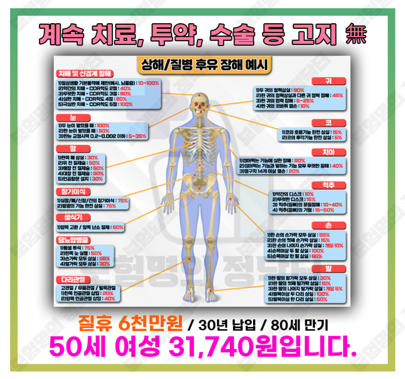 73년생에게 남여에게 추천하는「질병후유장해 혼합설계」입니다 네이버 블로그
